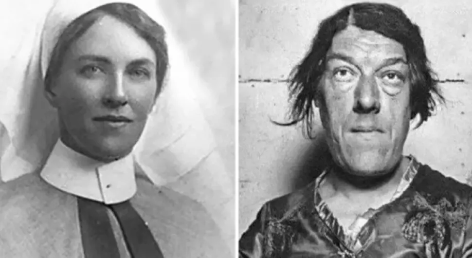 Tragična priča o najružnijoj ženi na svijetu: Bila je ljepotica, a onda ...